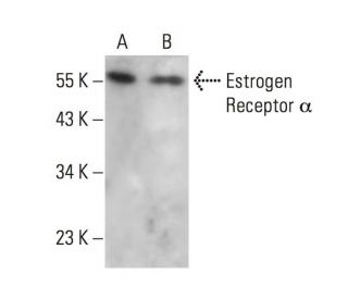 Estrogen Receptor alpha Antibody (H226) - Western Blotting - Image 377610