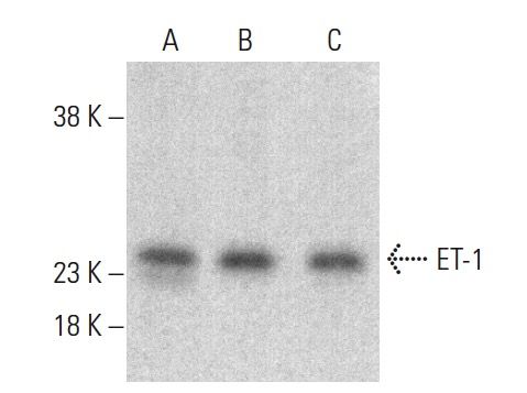 Endothelin-1/EDN1/ET-1抗体 (C7) | SCBT - Santa Cruz Biotechnology