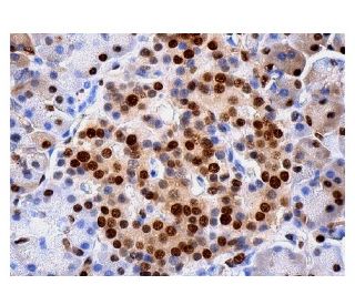 EWS Antibody (G-5) - Immunohistochemistry - Image 156810