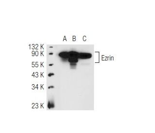 Ezrin Antibody (3C12) - Western Blotting - Image 56254