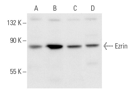 Anti-Ezrin Antibody (4A5) | SCBT - Santa Cruz Biotechnology