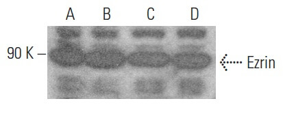 Anti-Ezrin Antibody (4A5) | SCBT - Santa Cruz Biotechnology