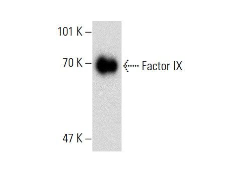 Factor IX Antibody (13B9) | SCBT - Santa Cruz Biotechnology