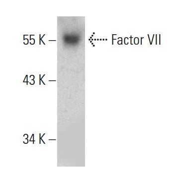 Factor VII Antibody (RFF-VII/2) | SCBT - Santa Cruz Biotechnology