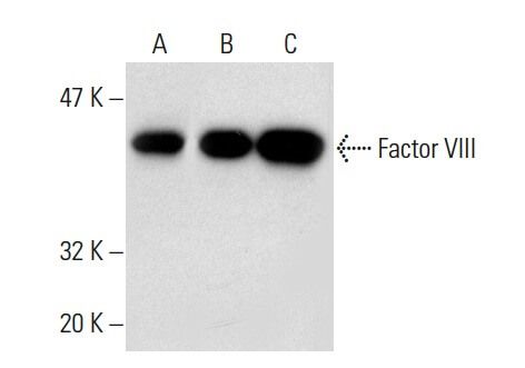 Factor VIII抗体 (GMA-012) | SCBT - Santa Cruz Biotechnology