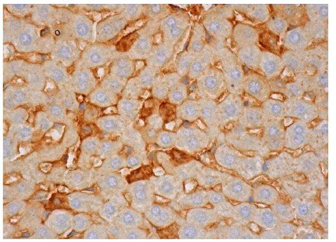 Anti-Factor XI Antibody (G-2) | SCBT - Santa Cruz Biotechnology