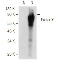Anti-Factor XI Antibody (G-2) | SCBT - Santa Cruz Biotechnology