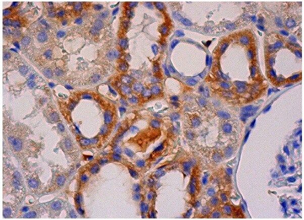 Factor XII Antibody (C-8) | SCBT - Santa Cruz Biotechnology