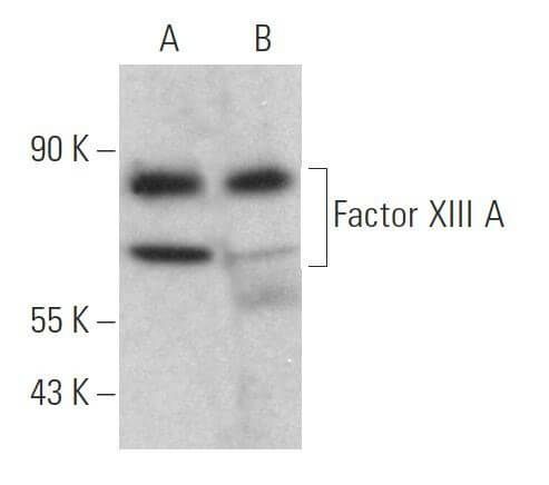 Factor XIII A Antibody (B-8) | SCBT - Santa Cruz Biotechnology