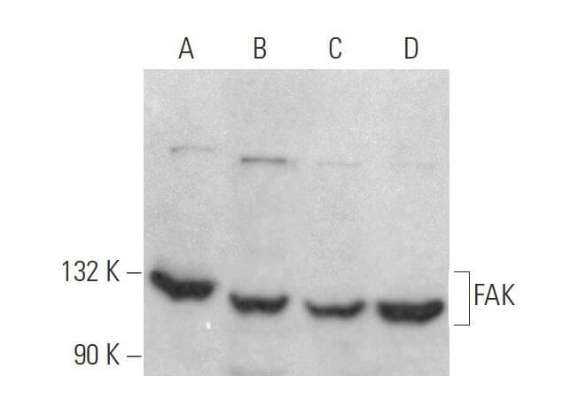 Anti-FAK Antibody (B-8) | SCBT - Santa Cruz Biotechnology
