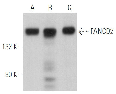 Anti-FANCD2 Antibody (FI17) | SCBT - Santa Cruz Biotechnology