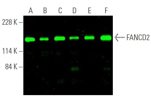 Anti-FANCD2 Antibody (FI17) | SCBT - Santa Cruz Biotechnology
