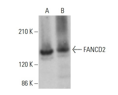 Anti-FANCD2 Antibody (FI17) | SCBT - Santa Cruz Biotechnology