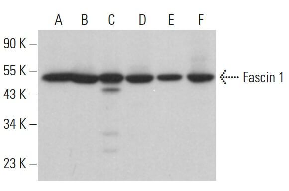 Fascin 1 Antibody (D-10) | SCBT - Santa Cruz Biotechnology
