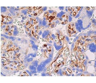 Anti-FcRn Antibody (B-8) | SCBT - Santa Cruz Biotechnology