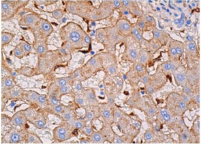 Anti-FcRn Antibody (B-8) | SCBT - Santa Cruz Biotechnology