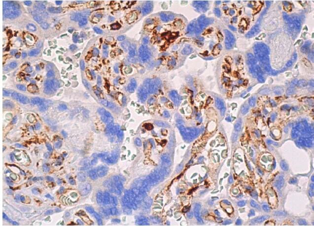 Anti-FcRn Antibody (B-8) | SCBT - Santa Cruz Biotechnology