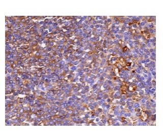 ferritin light chain Antibody (D-9) - Immunohistochemistry - Image 157201