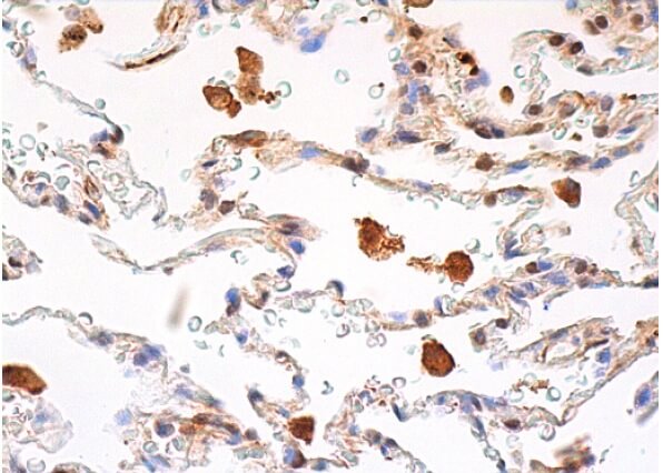 ferritin light chain Antibody (D-9) | SCBT - Santa Cruz Biotechnology