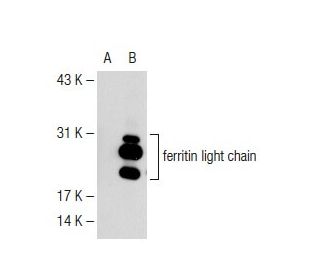 Anti-ferritin light chain Antibody (D-9) | SCBT - Santa Cruz Biotechnology
