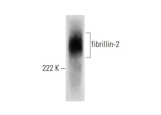 fibrillin-2 Antibody (H-10) | SCBT - Santa Cruz Biotechnology