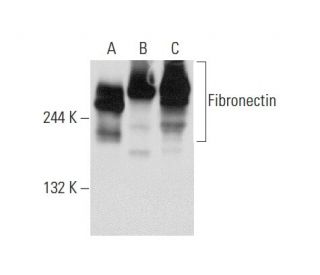 Fibronectin Antibody (EP5) - Western Blotting - Image 62213