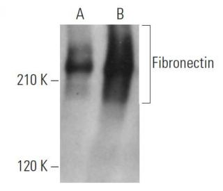 Fibronectin Antibody (EP5) - Western Blotting - Image 361798