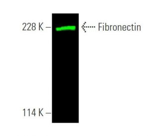 Fibronectin Antibody (EP5) - Western Blotting - Image 371781