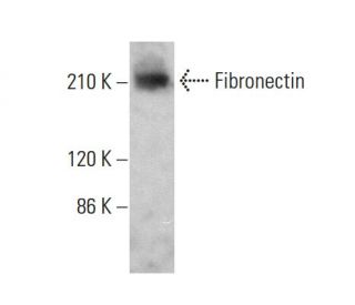 Fibronectin Antibody (IST-1) | SCBT - Santa Cruz Biotechnology