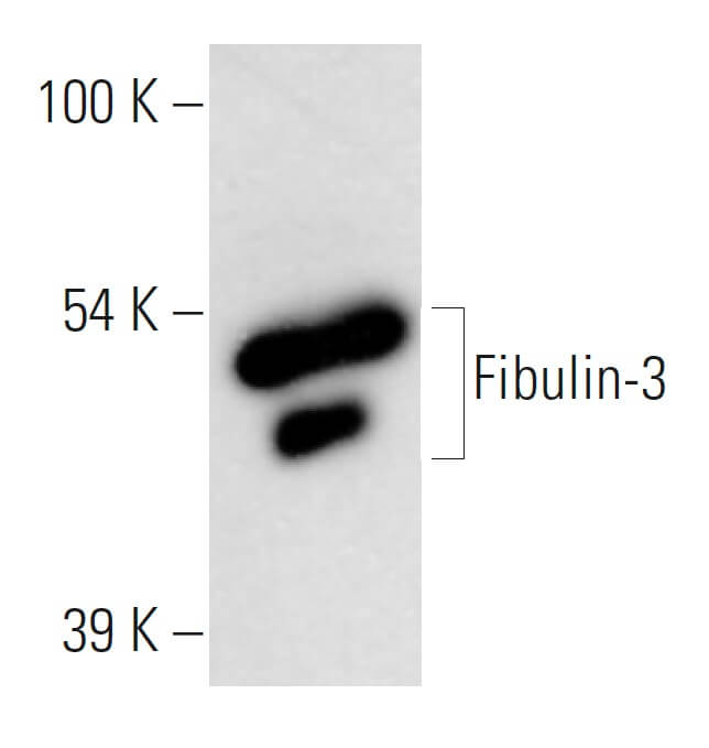Anti-Fibulin-3 Antibody (mab3-5) | SCBT - Santa Cruz Biotechnology
