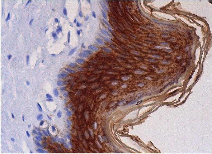 FLG/Filaggrin Antibody (AE21) | SCBT - Santa Cruz Biotechnology