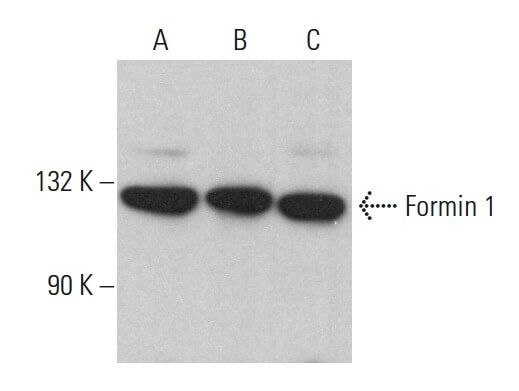 Formin 1 Antibody (H-5) | SCBT - Santa Cruz Biotechnology