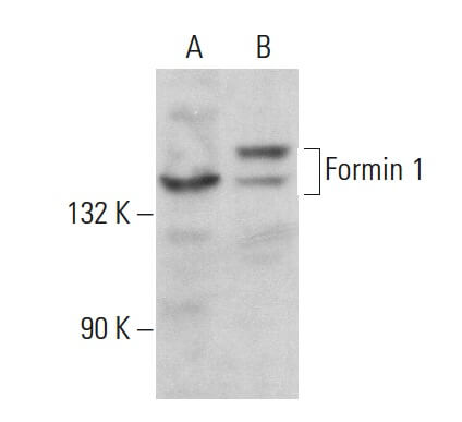 Formin 1 Antibody (H-5) | SCBT - Santa Cruz Biotechnology