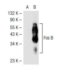 Fos B抗体 (83B1138) | SCBT - Santa Cruz Biotechnology