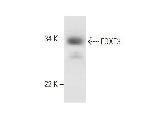 FOXE3 Antibody (G-1) | SCBT - Santa Cruz Biotechnology