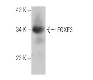 FOXE3 Antibody (G-1) | SCBT - Santa Cruz Biotechnology