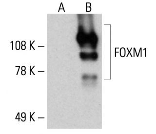 FOXM1 Antibody (G-5) - Western Blotting - Image 155690