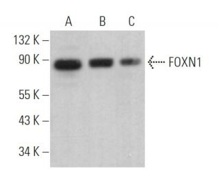 FOXN1 Antibody (E-3) - Western Blotting - Image 363456
