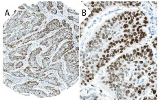 Fra-1 Antibody (C-12) | SCBT - Santa Cruz Biotechnology
