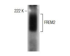 FREM2抗体 (F-1) | SCBT - Santa Cruz Biotechnology