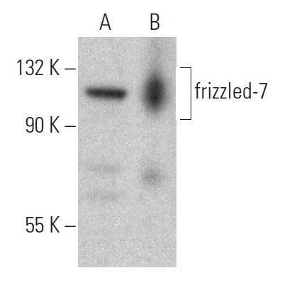 frizzled-7 Antibody (4D9) | SCBT - Santa Cruz Biotechnology