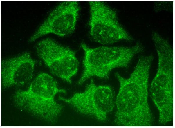FSD2 Antibody (C-5) | SCBT - Santa Cruz Biotechnology