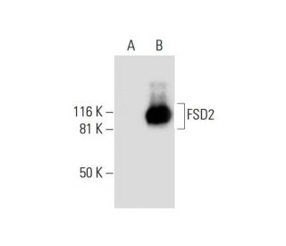 Anti-FSD2 Antibody (H-11) | SCBT - Santa Cruz Biotechnology