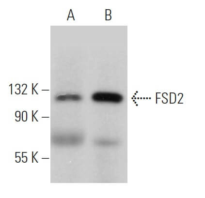 Anti-FSD2 Antibody (H-11) | SCBT - Santa Cruz Biotechnology