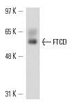 FTCD Antibody (58K-9) | SCBT - Santa Cruz Biotechnology