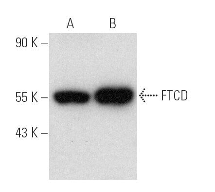 FTCD Antibody (G-3) | SCBT - Santa Cruz Biotechnology
