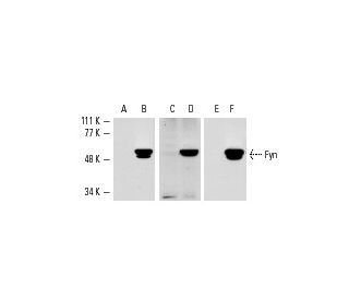 Fyn Antibody (15) | SCBT - Santa Cruz Biotechnology