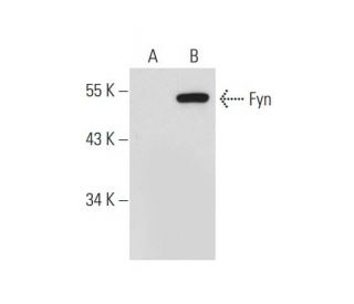 Fyn Antibody (15) | SCBT - Santa Cruz Biotechnology