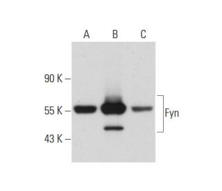 Fyn Antibody (FYN-01) - Western Blotting - Image 131666