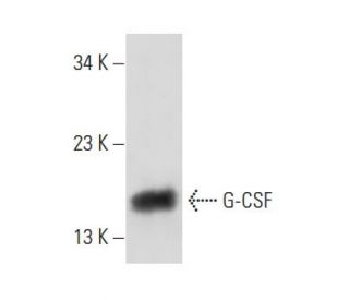 G-CSF Antibody (3D1) - Western Blotting - Image 13595